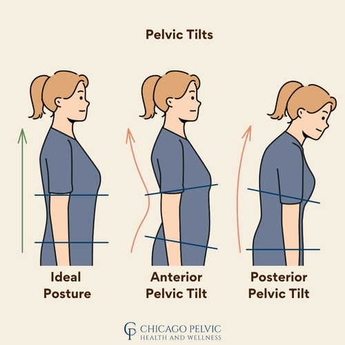 Mastering the Pelvic Tilt: A Complete Guide for Back Pain and Core Strength