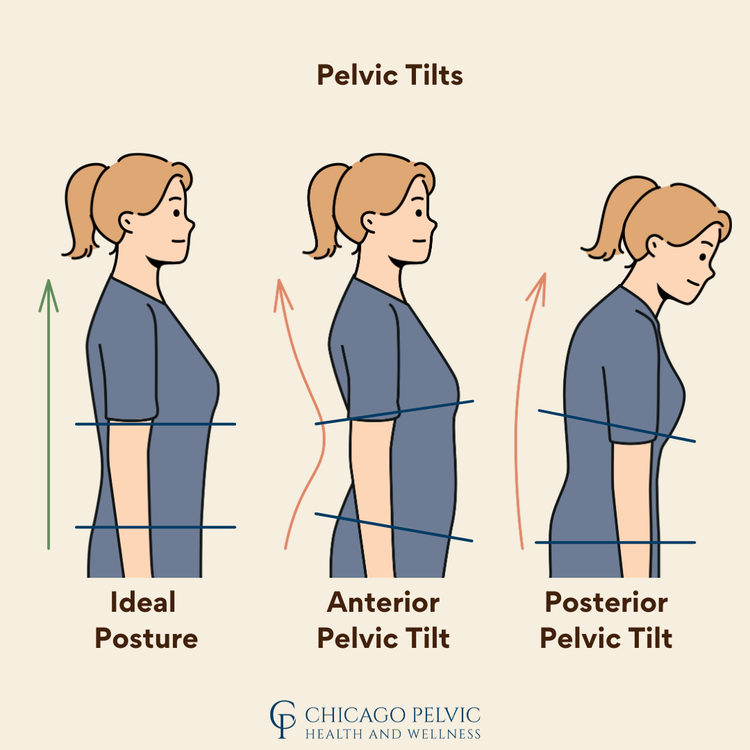 Mastering the Pelvic Tilt: A Complete Guide for Back Pain and Core Strength