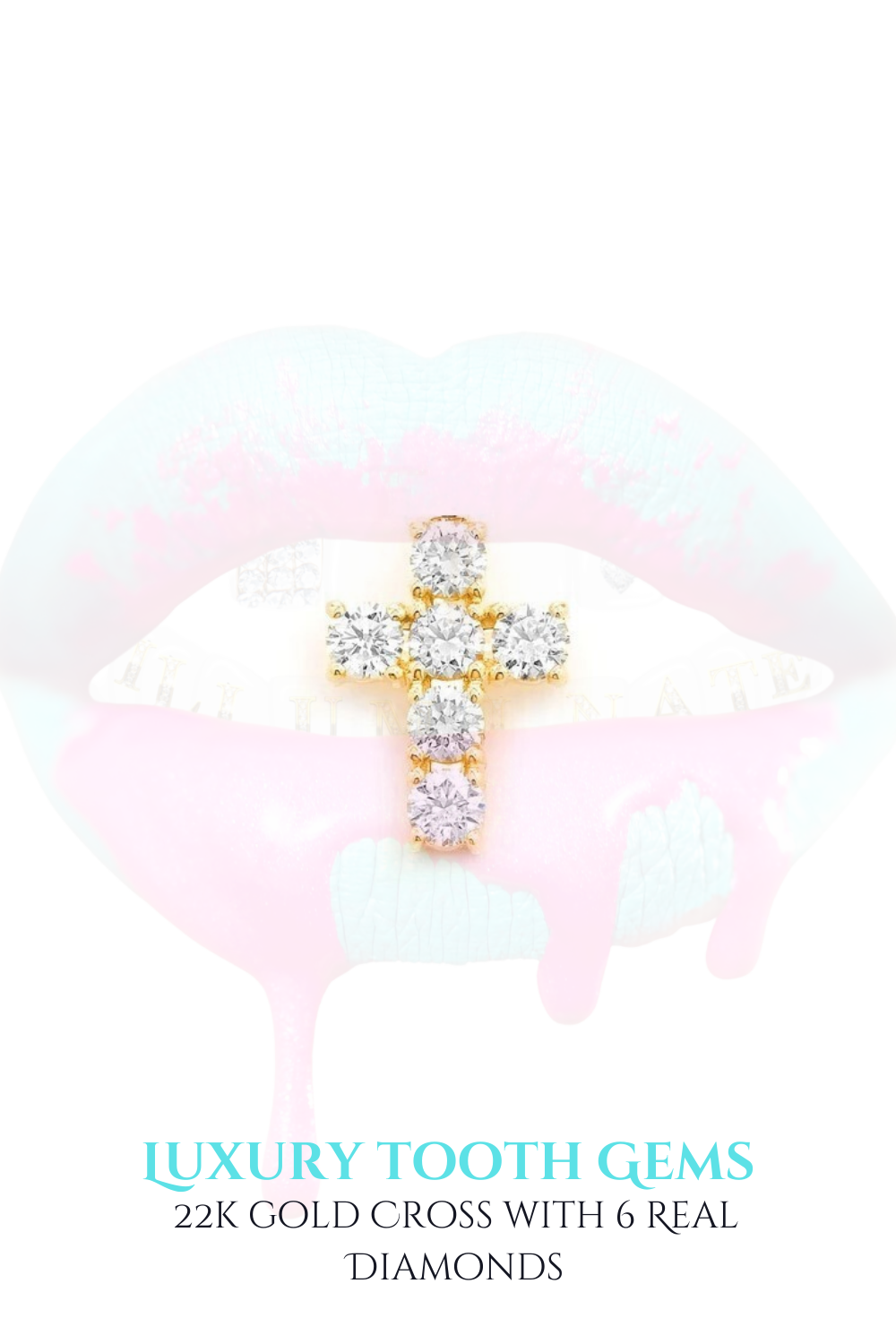 Wholesale Tooth Gems & Teeth Whitening Supplies — ILLUMINATE SMILE ...