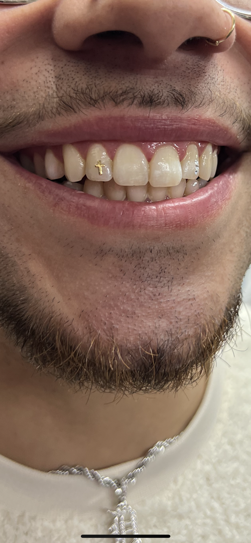 Services 1 — ILLUMINATE SMILE SPECIALISTS