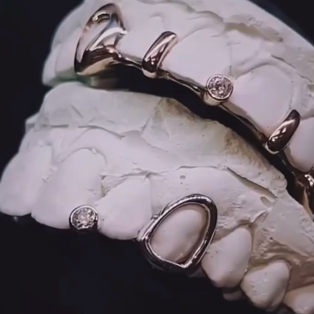 Custom Grillz — ILLUMINATE SMILE SPECIALISTS