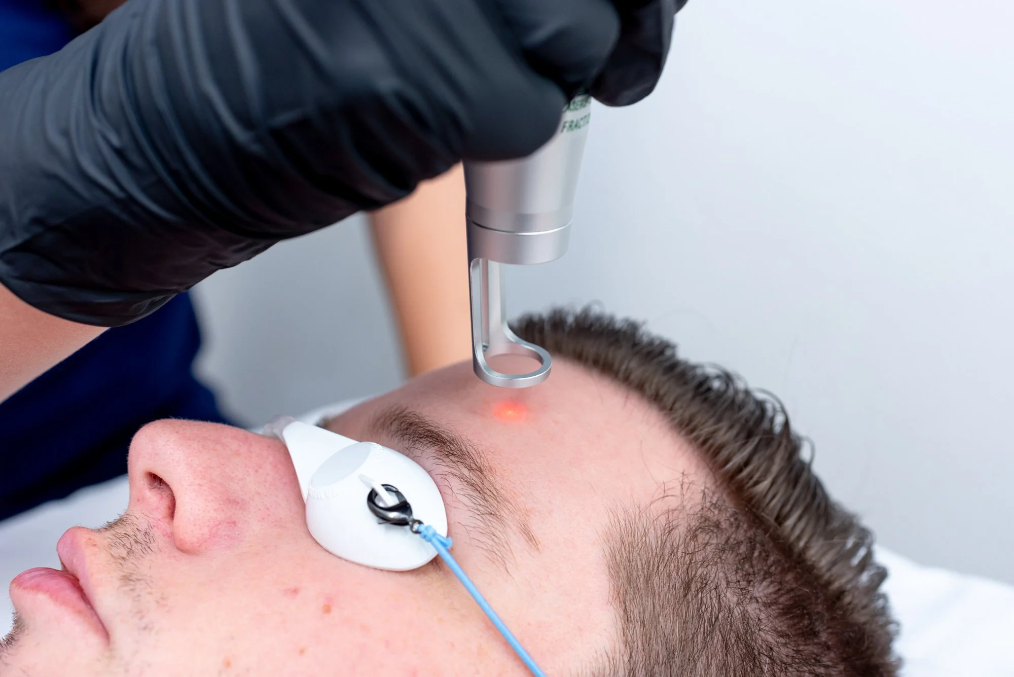 Lasers — LASEROPTEK