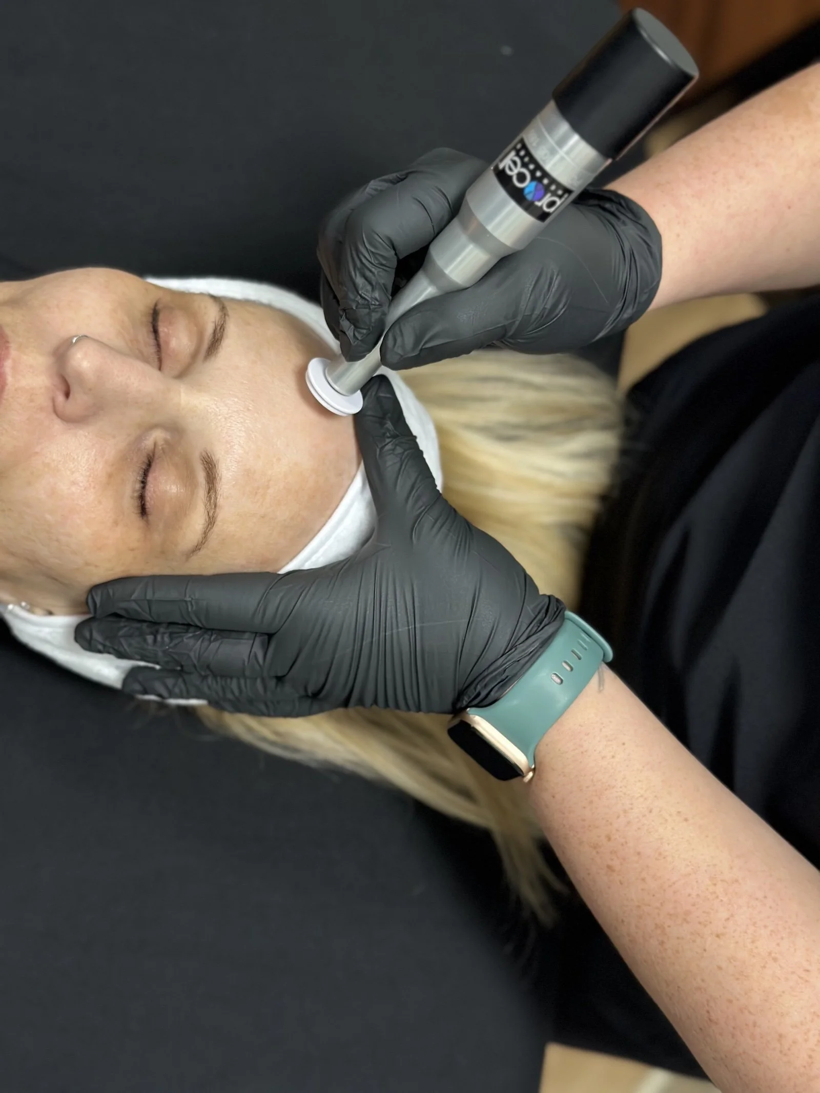 Microneedling — Amplify Aesthetics