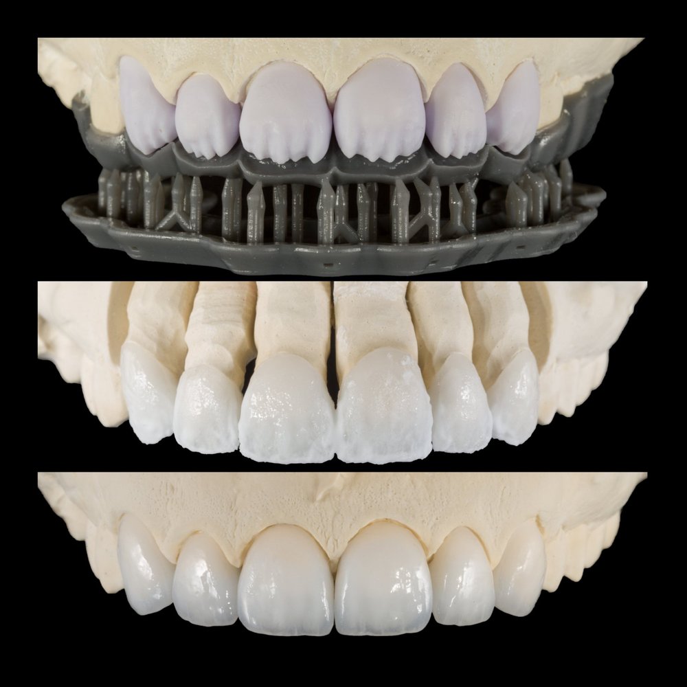 VeneerLab. Dental Aesthetics - a Cosmetic Dental Laboratory