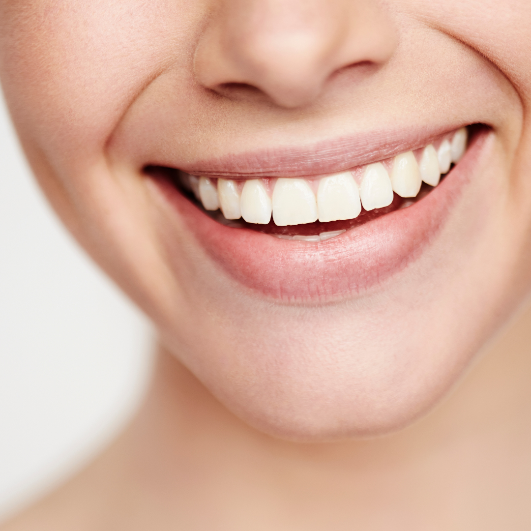 Night Guards - Harvest Dental Care