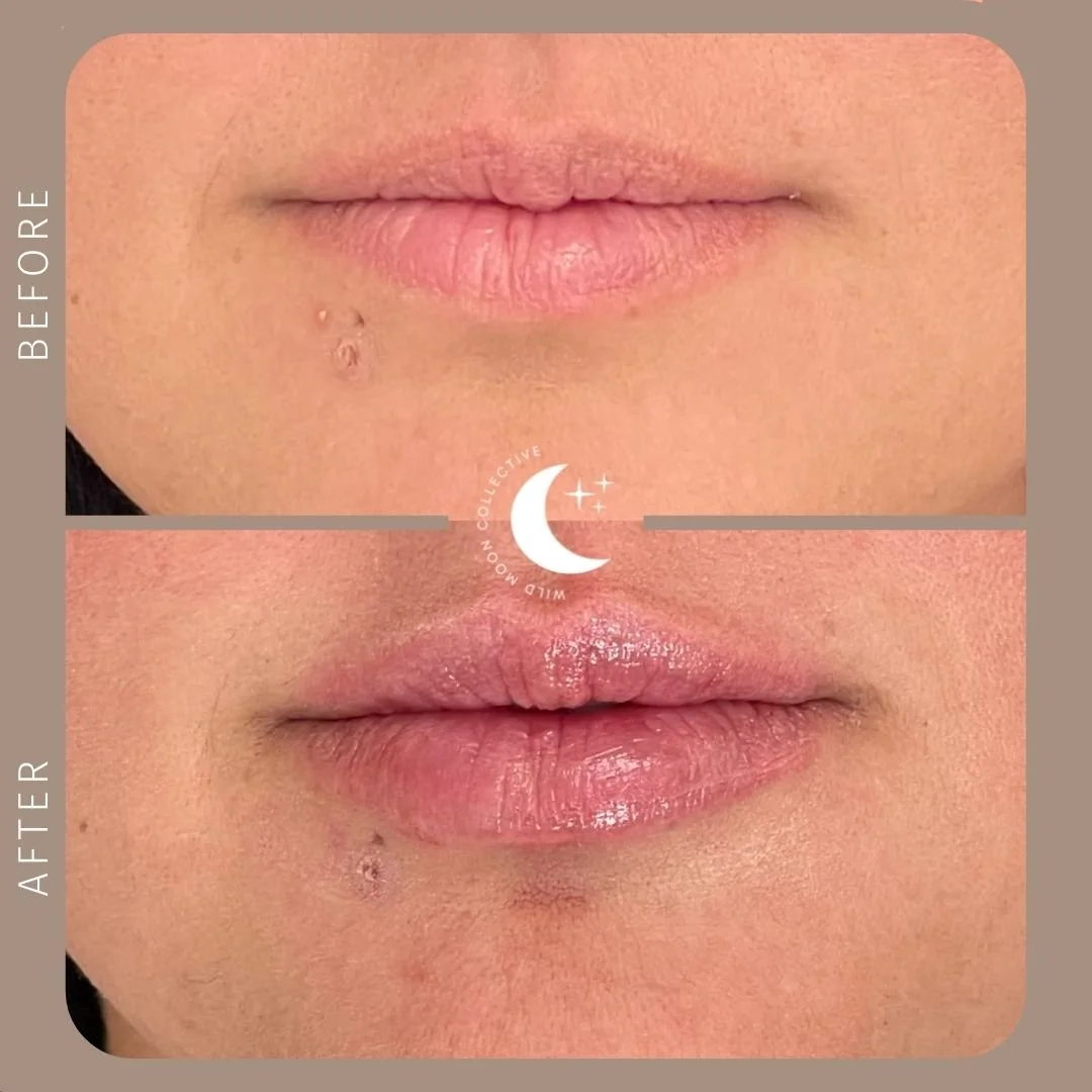 Med Spa Libertyville, IL | Cosmetic Services | Wild Moon Collective