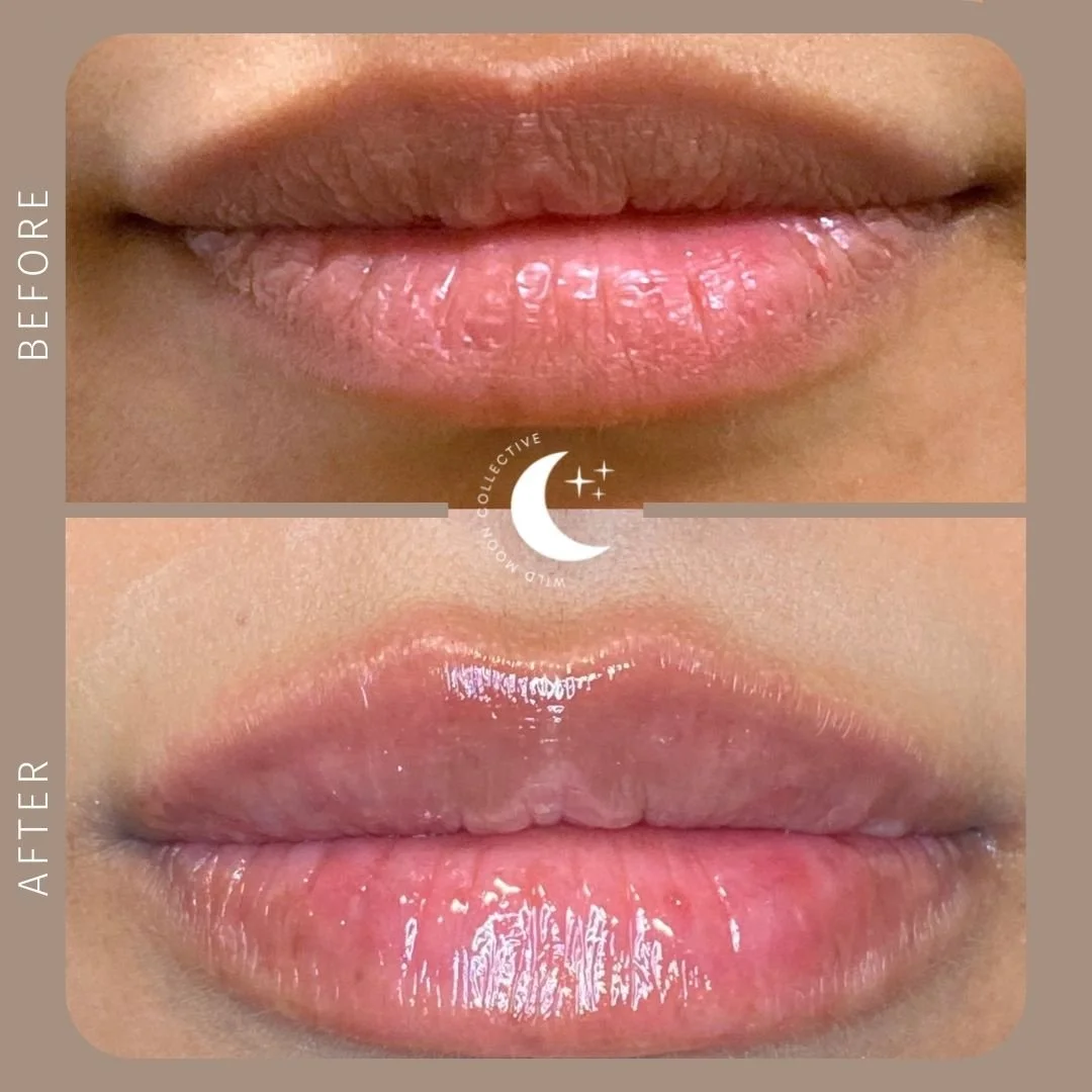 Med Spa Libertyville, IL | Cosmetic Services | Wild Moon Collective