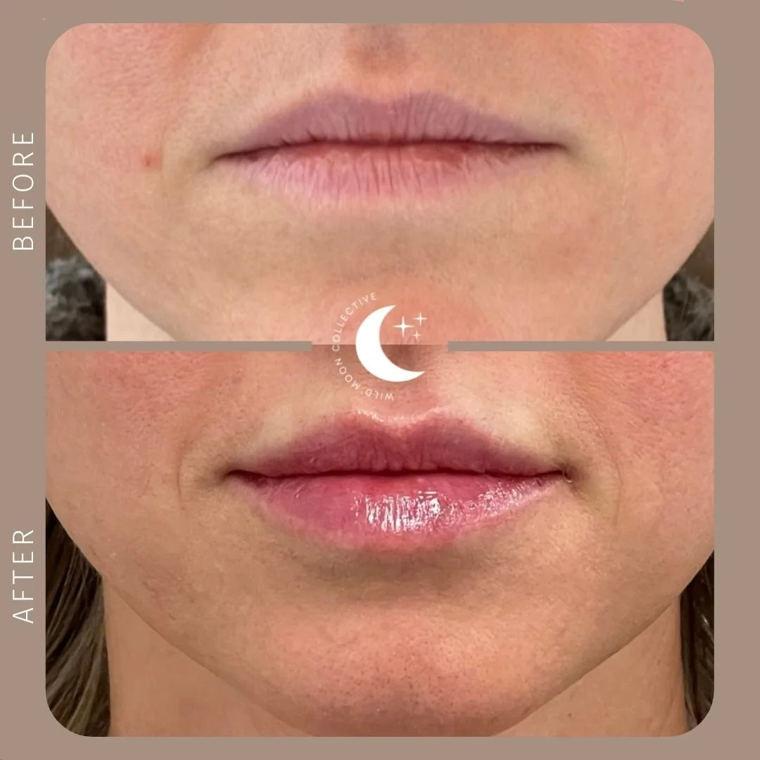 Med Spa Libertyville, IL | Cosmetic Services | Wild Moon Collective