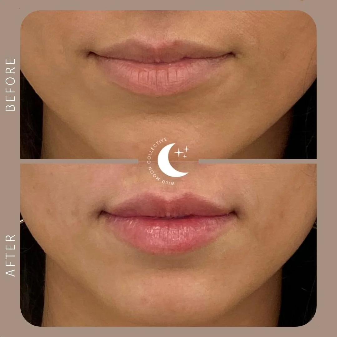 Med Spa Libertyville, IL | Cosmetic Services | Wild Moon Collective