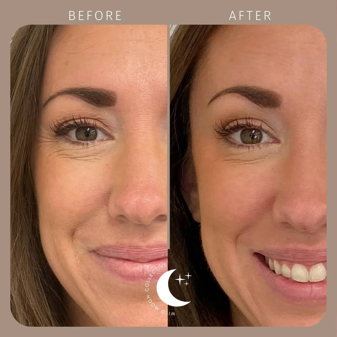 Med Spa Libertyville, IL | Cosmetic Services | Wild Moon Collective