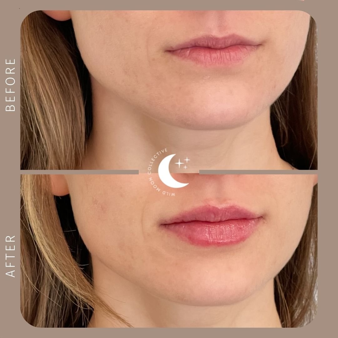 Med Spa Libertyville, IL | Cosmetic Services | Wild Moon Collective