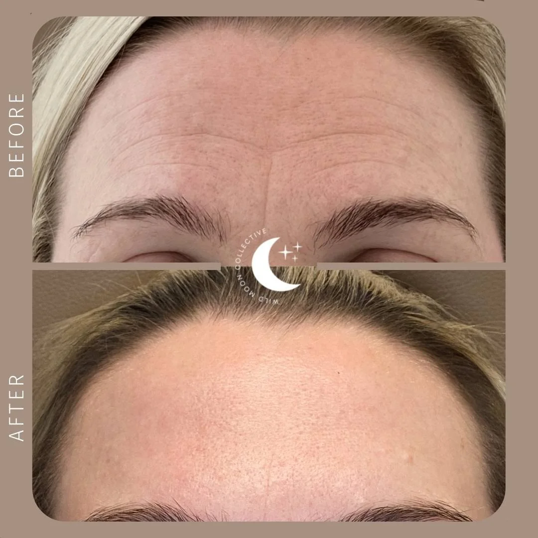 Med Spa Libertyville, IL | Cosmetic Services | Wild Moon Collective