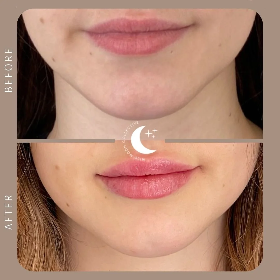 Med Spa Libertyville, IL | Cosmetic Services | Wild Moon Collective