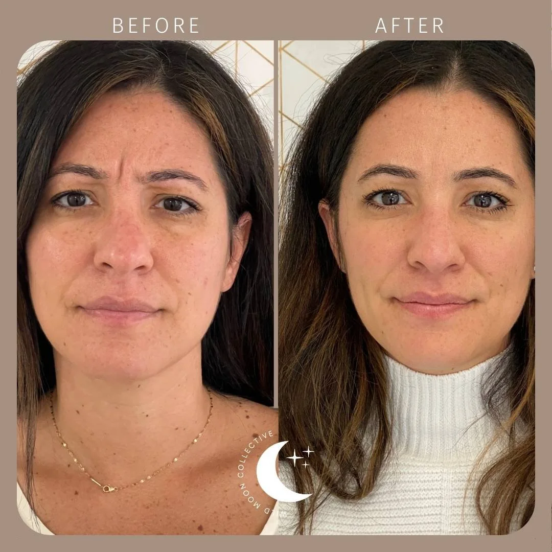 Med Spa Libertyville, IL | Cosmetic Services | Wild Moon Collective