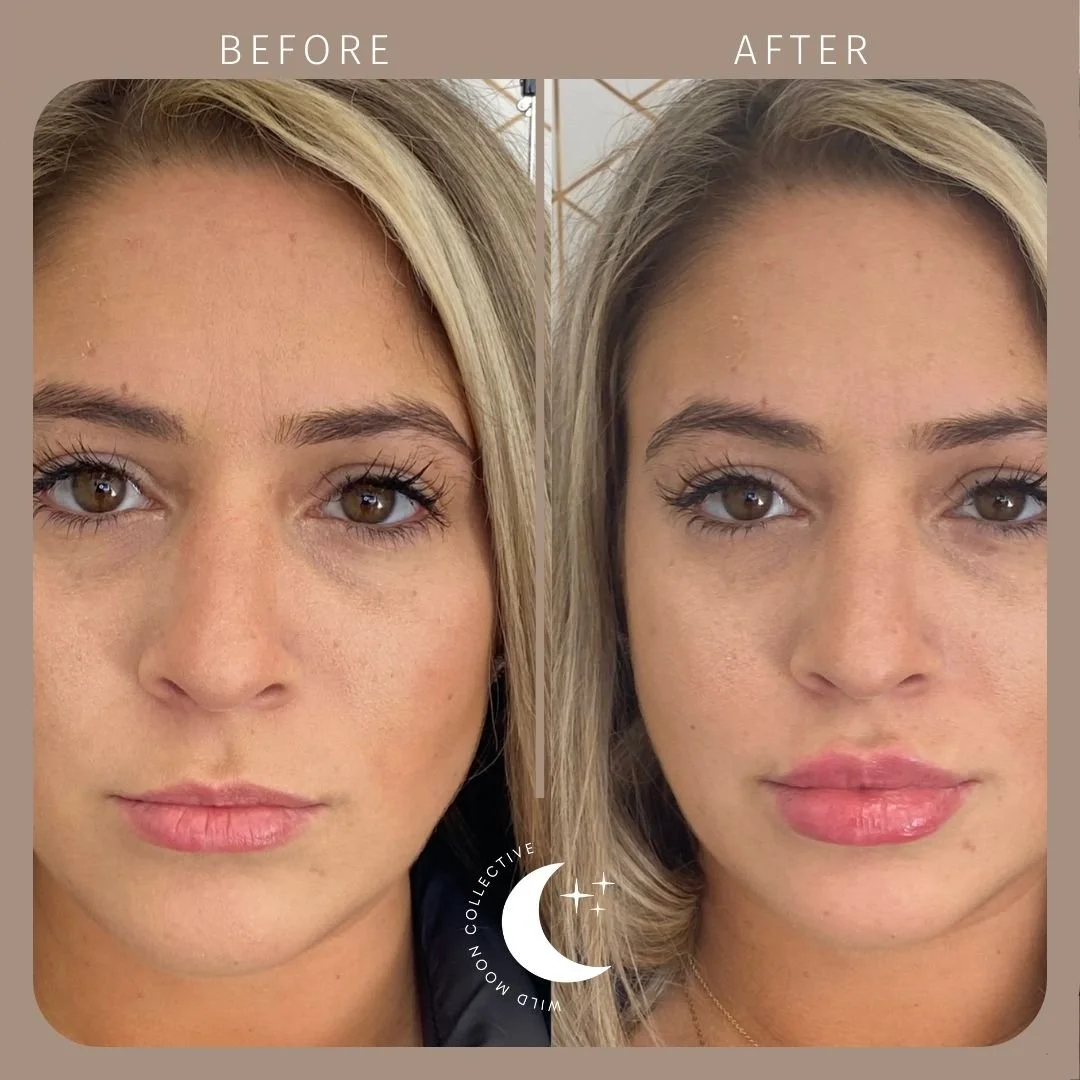 Med Spa Libertyville, IL | Cosmetic Services | Wild Moon Collective