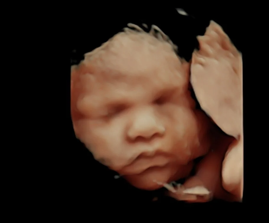 Packages/Appointments — Peek a-boo baby Ultrasounds