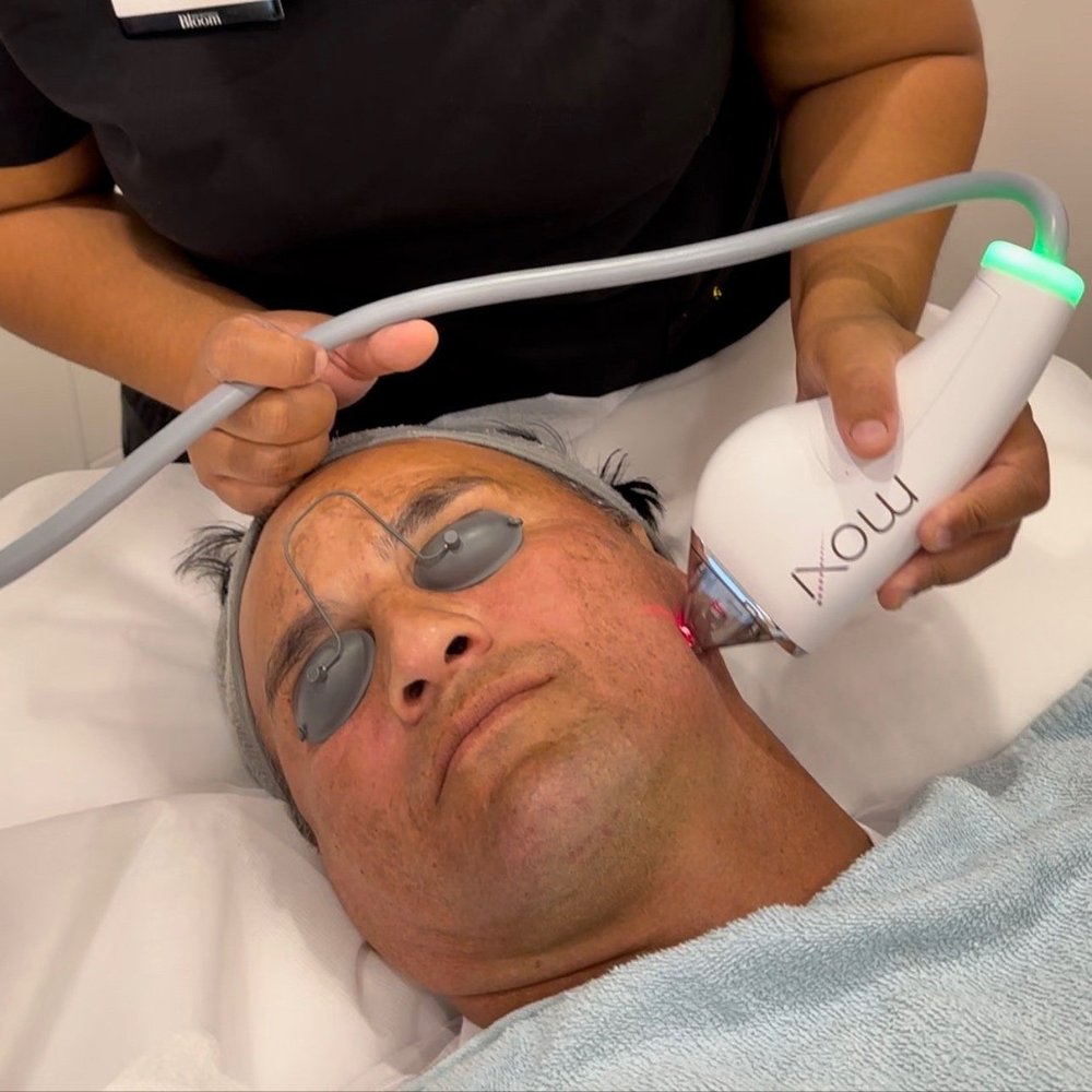 Moxi Laser — Bloom Skin Aesthetics