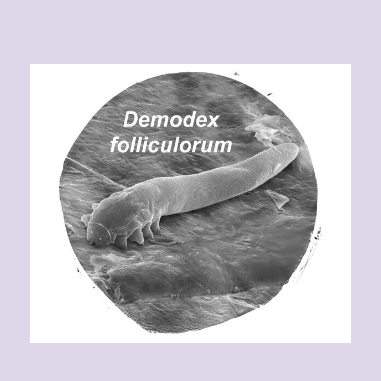 Demodex Treatment — Northeast Optometry