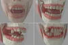 Dental 3d medical animation periodontal disease - Visualmedics Studio