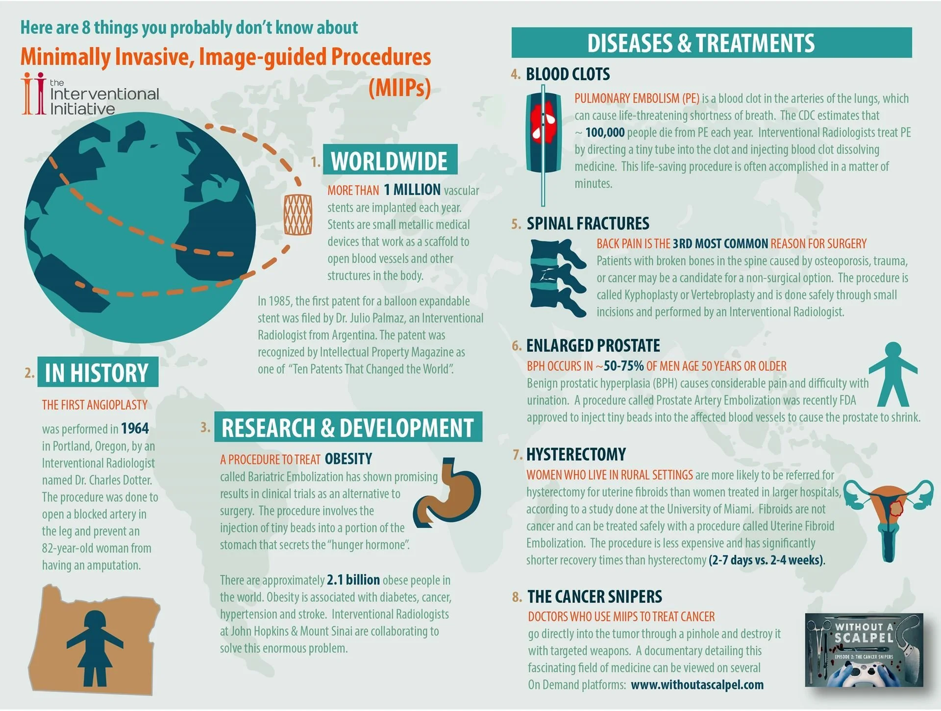 Infographics — The Interventional Initiative