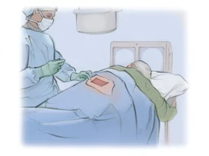 Nerve Blocks and Neurolysis — The Interventional Initiative