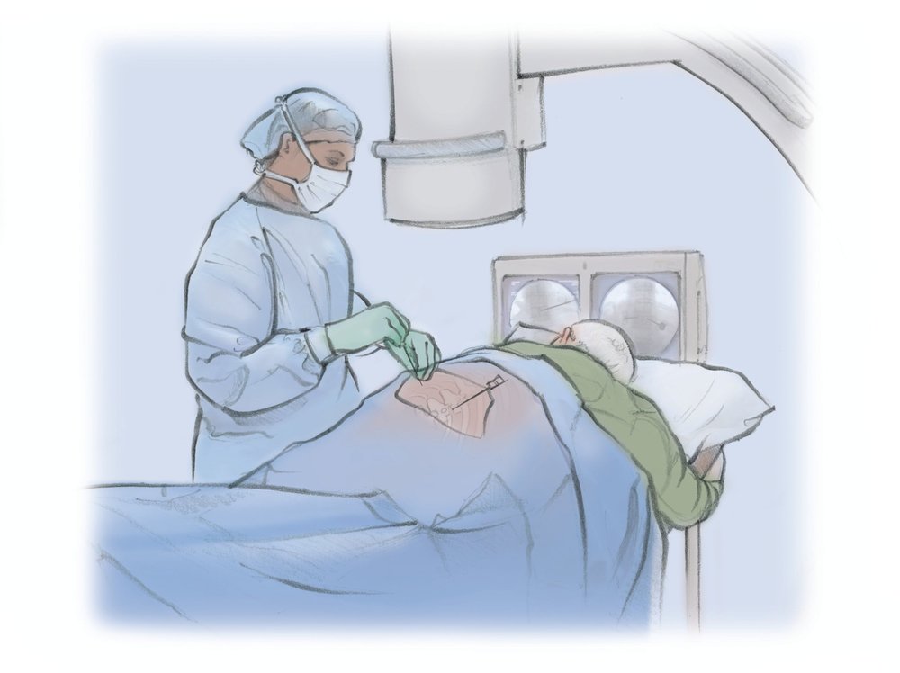 Nerve Blocks and Neurolysis — The Interventional Initiative