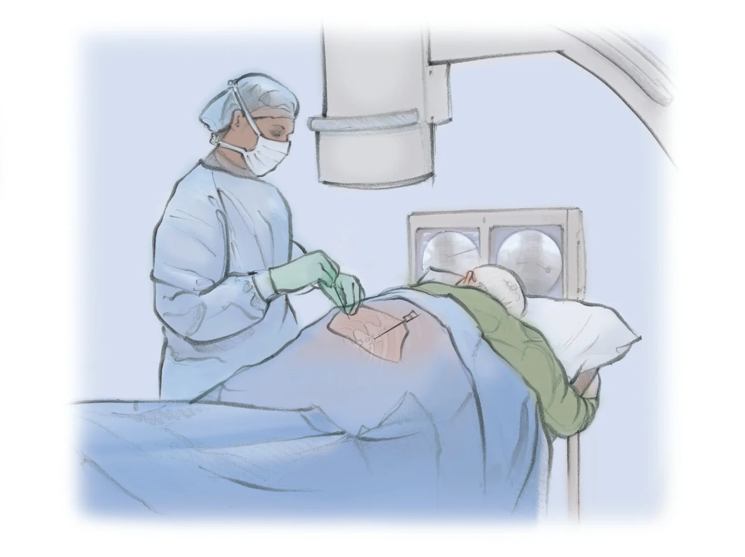 Neurolisis para el control del dolor — The Interventional Initiative