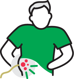 What happens after my Abscess Drain? — The Interventional Initiative