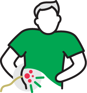 What happens after my Abscess Drain? — The Interventional Initiative