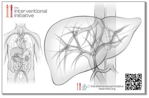 Scratch Pads — The Interventional Initiative