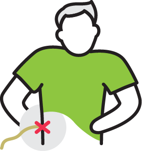 What happens after getting a bile duct drain or stent? — The ...