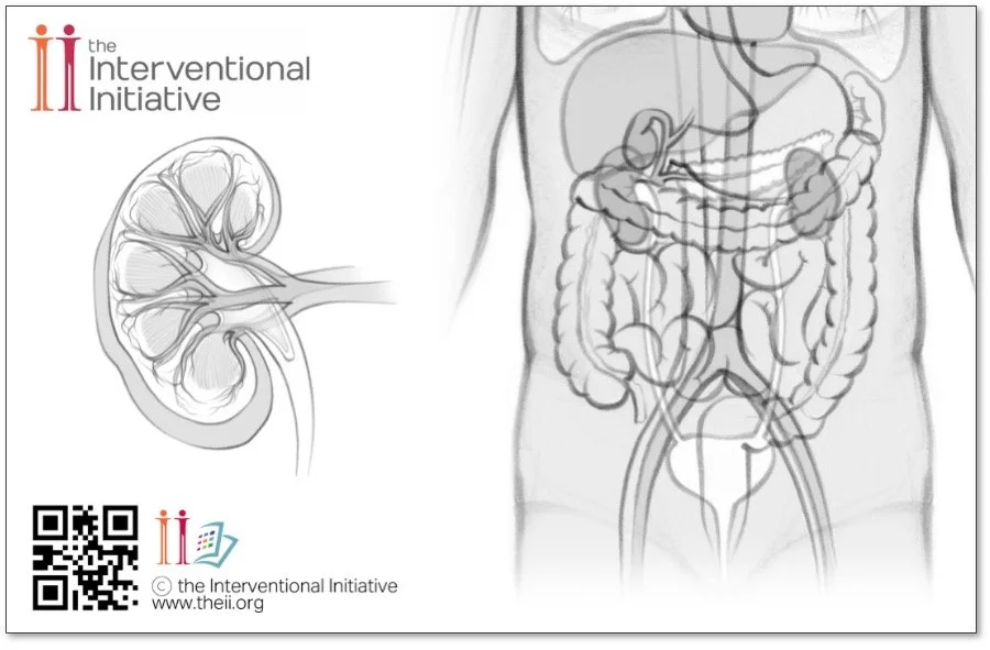 Scratch Pads — The Interventional Initiative