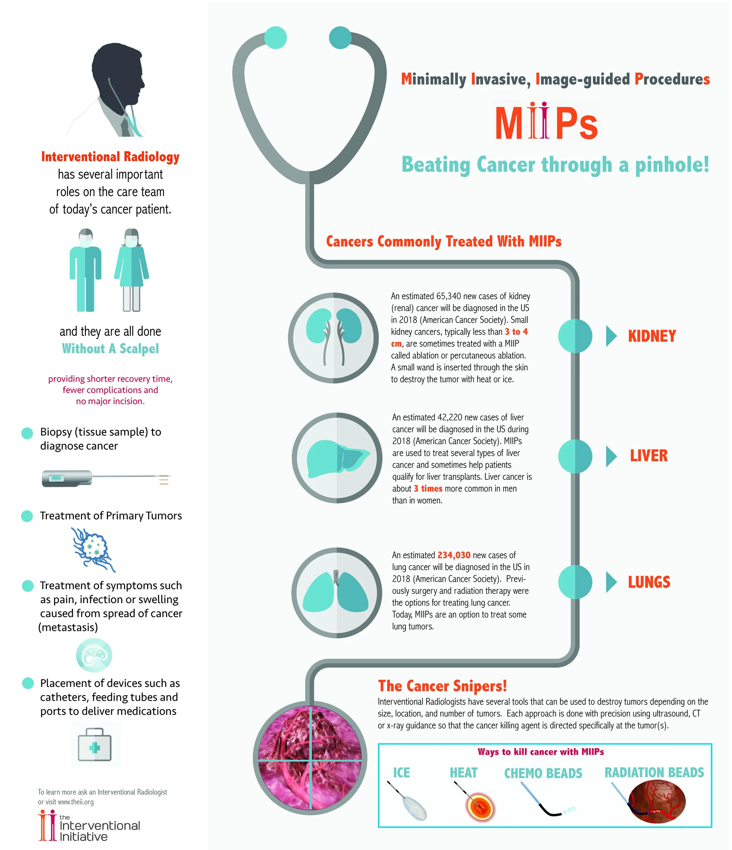 Infographics — The Interventional Initiative