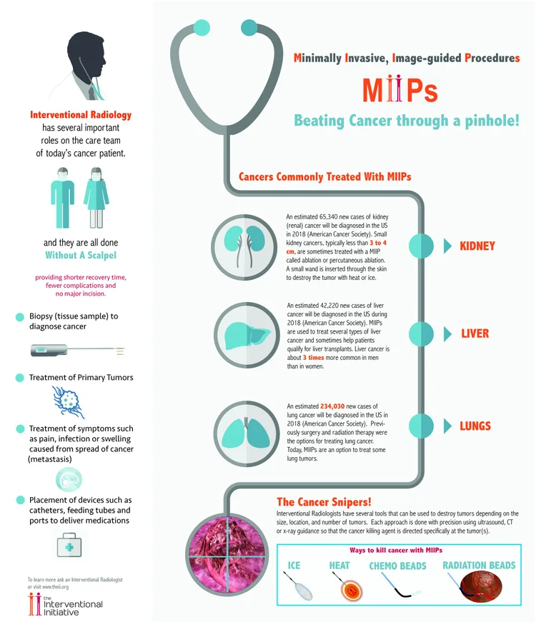 Infographics — The Interventional Initiative