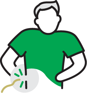 What happens after my Abscess Drain? — The Interventional Initiative