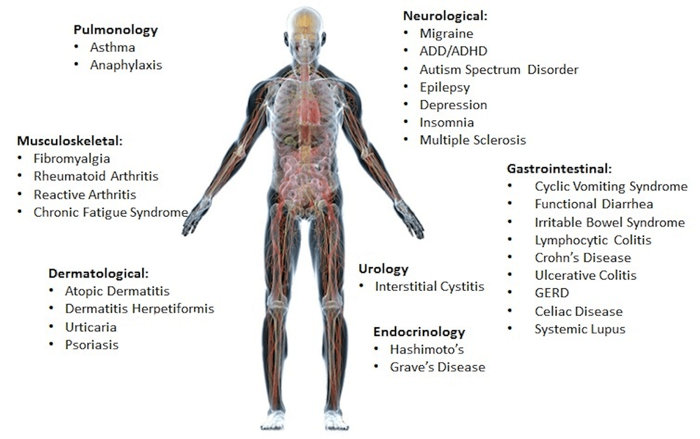 Food Chemical Sensitivity: Understanding the Foods, Symptoms, and ...