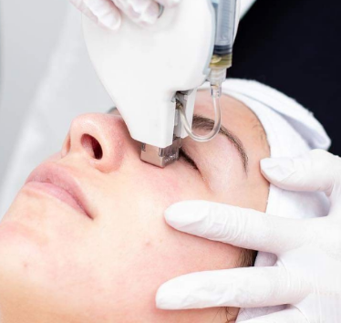 Services 3 — Clarity Cosmetic Laser Clinic