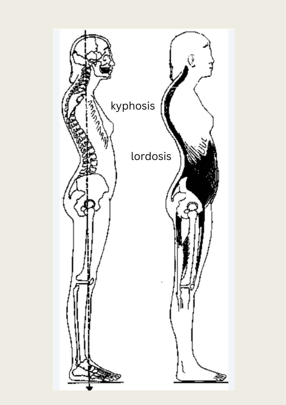 What Is Your Posture Type?