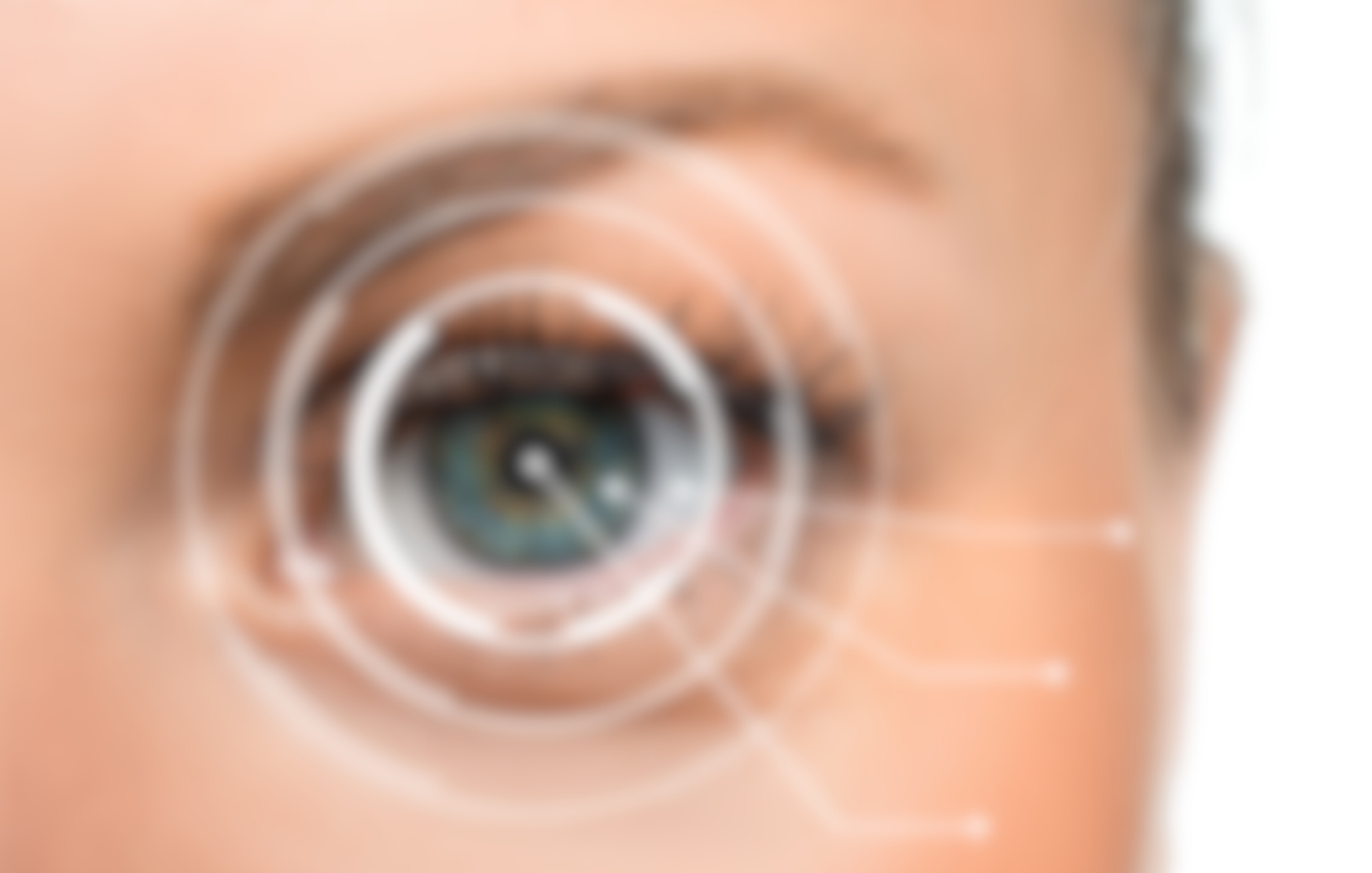 Laser Vision Correction — Chickasha Vision Center