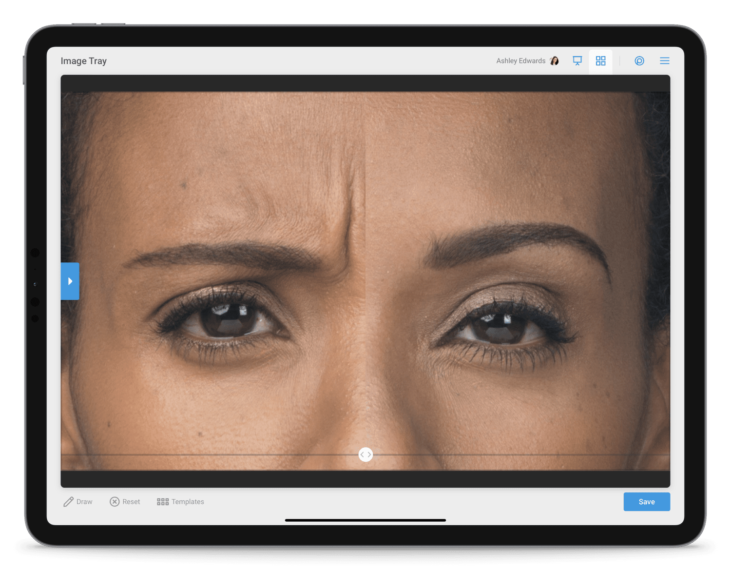 Consultation Software | TouchMD