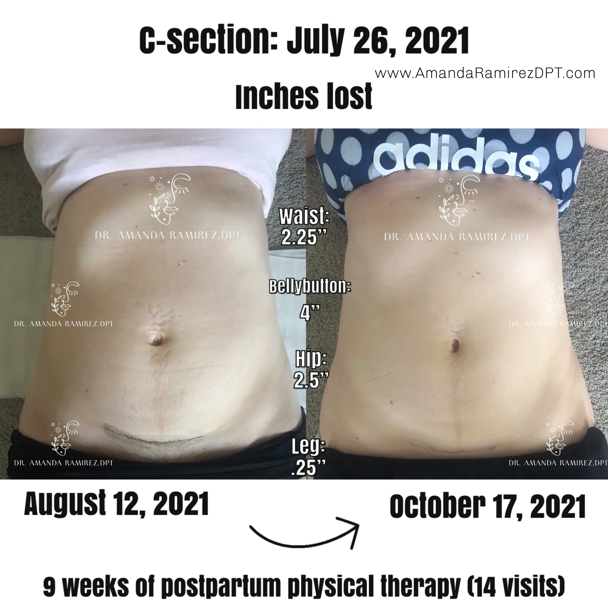 Portfolio — Dr. Amanda Ramirez, DPT