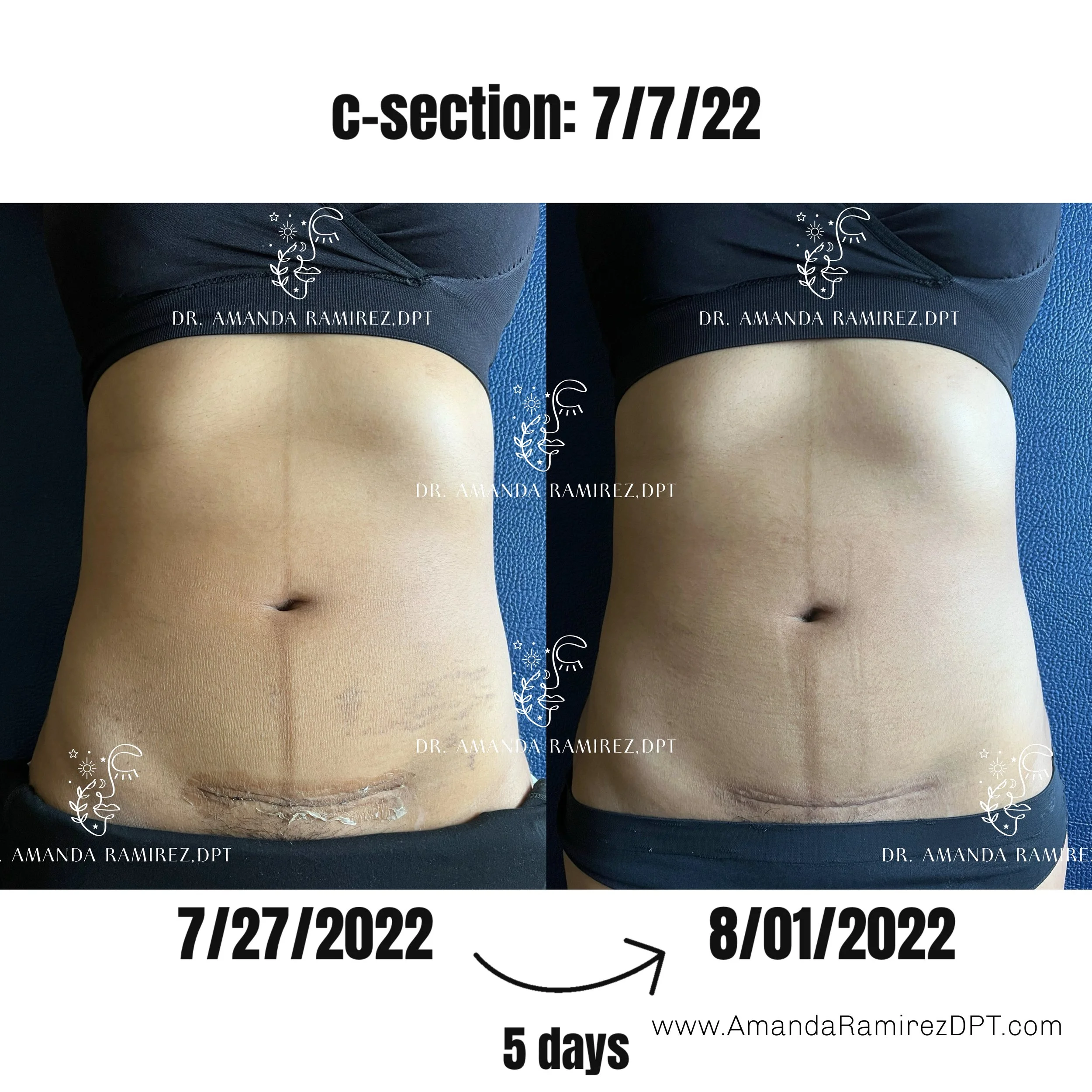 Portfolio — Dr. Amanda Ramirez, DPT