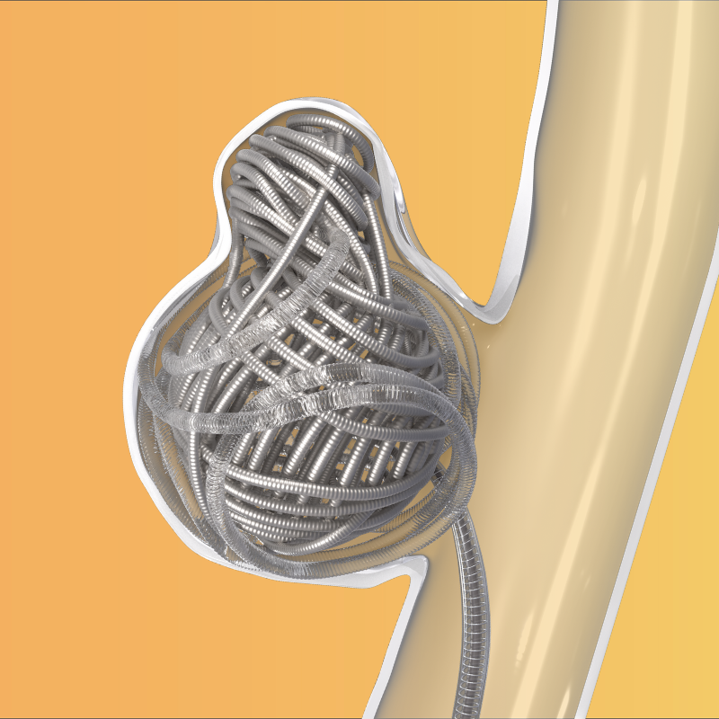 i-ED Coil — Kaneka Neurovascular USA