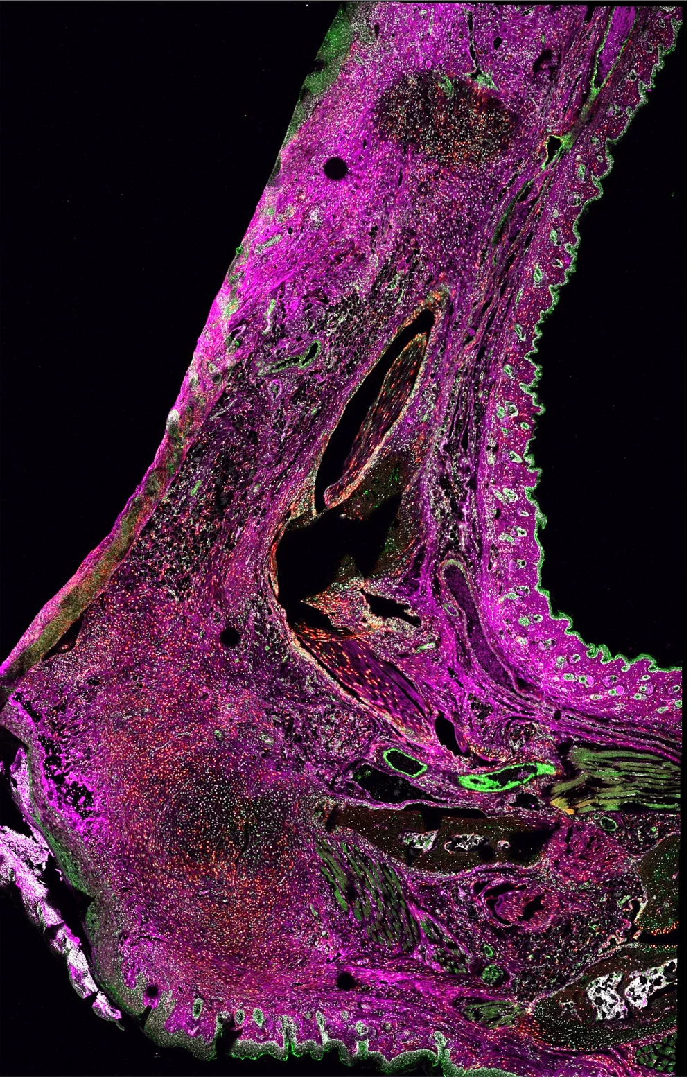 Biomaterials, Mechanics, & Tissue Engineering — Biomedical Engineering ...