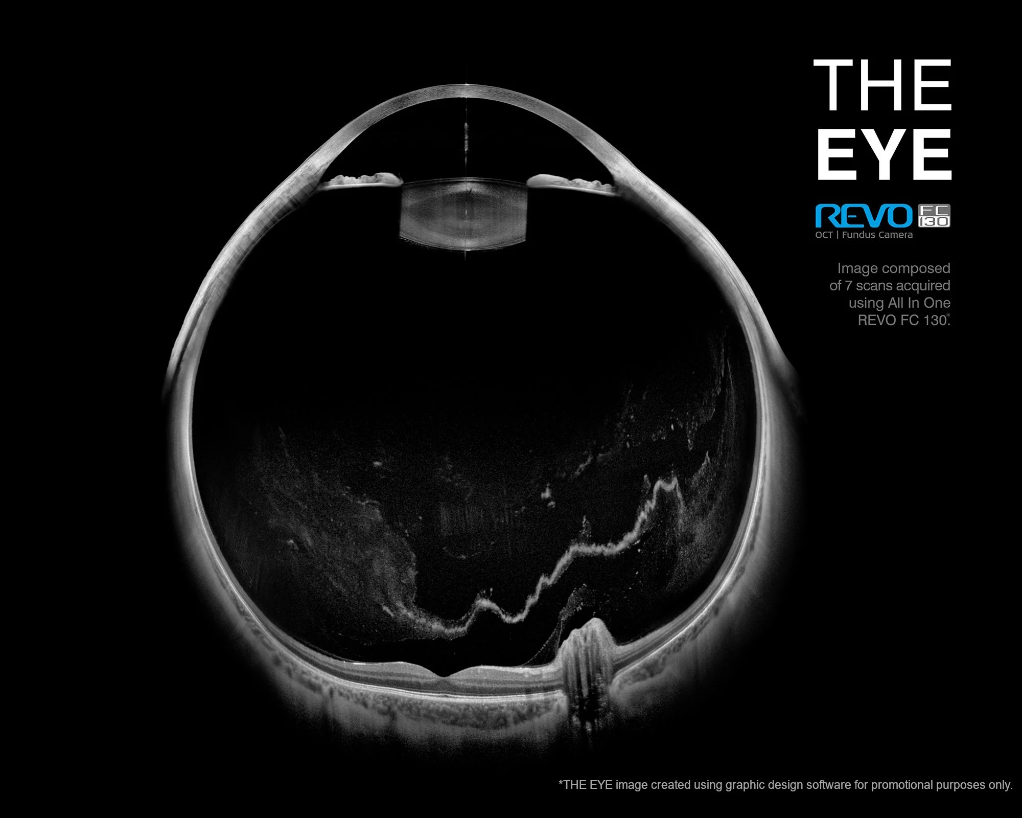 General 2- Clarion Vision Care | Eye Exams | Richmond Hill | Ortho K