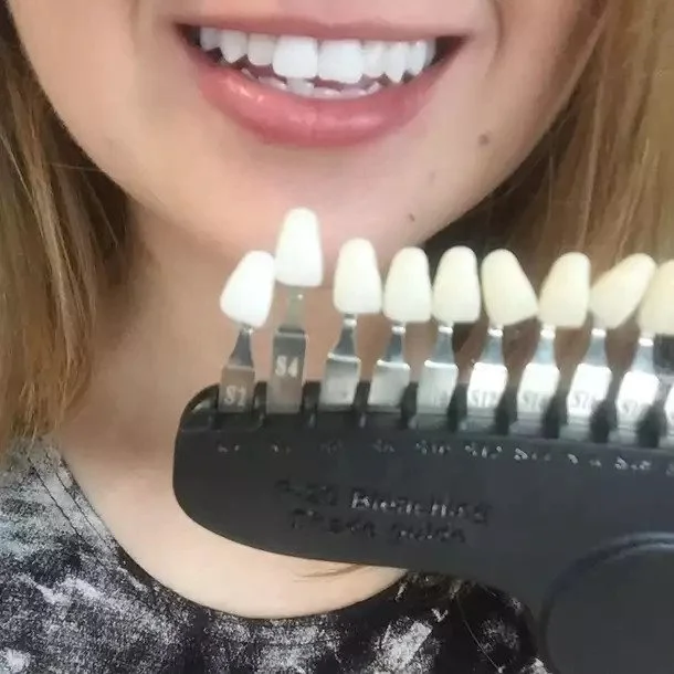 Icy White Mobile Teeth Whitening