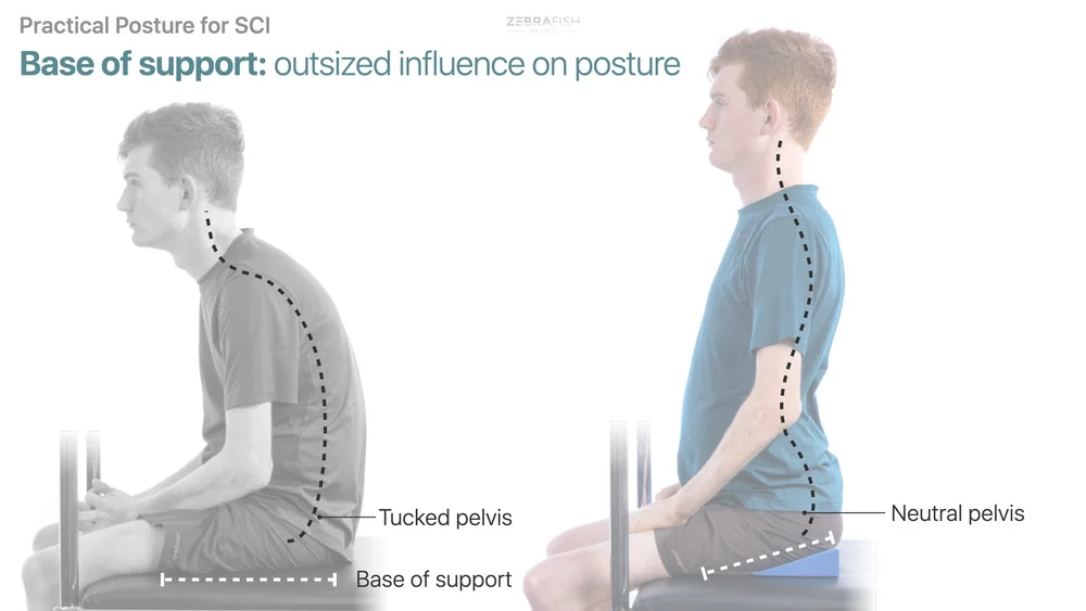 DIY SCI Rehab Programs: Improving posture at-home through Floor-based ...