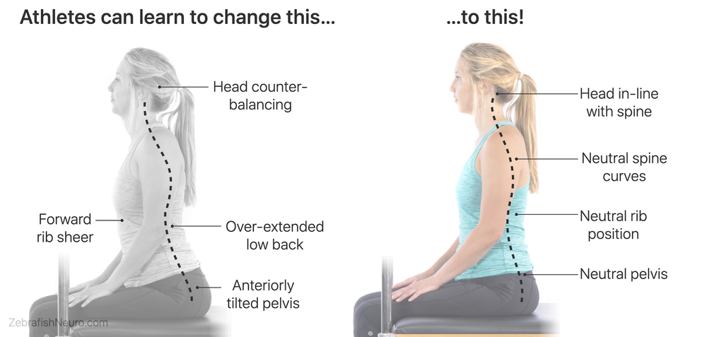 SCI exercises: improving posture