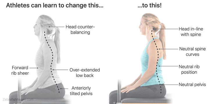 SCI exercises: improving posture