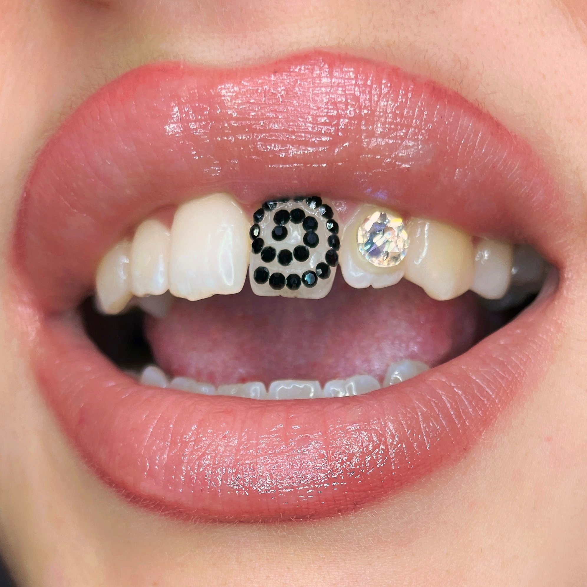 Sia Icy - Tooth Gem Kits